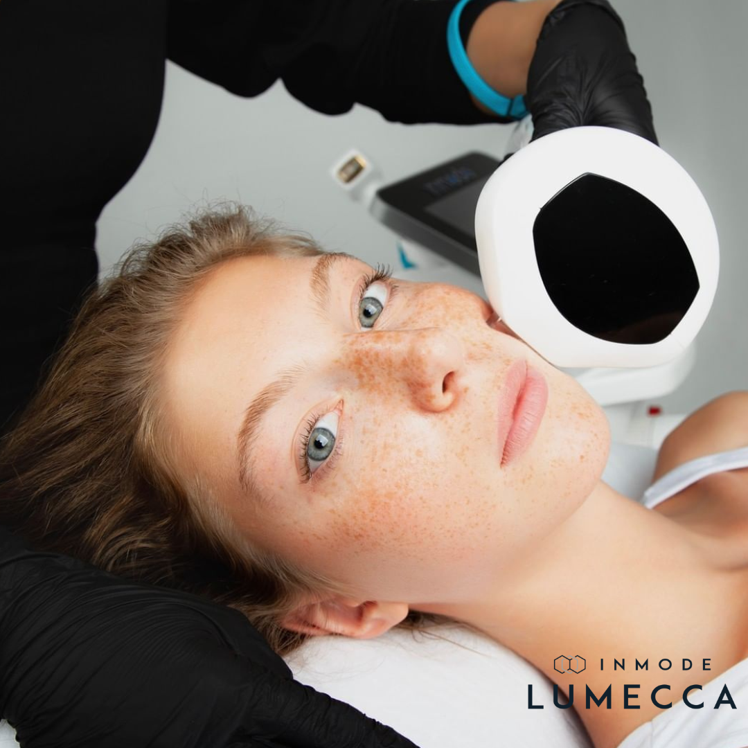 IPL Lumecca технологія InMode